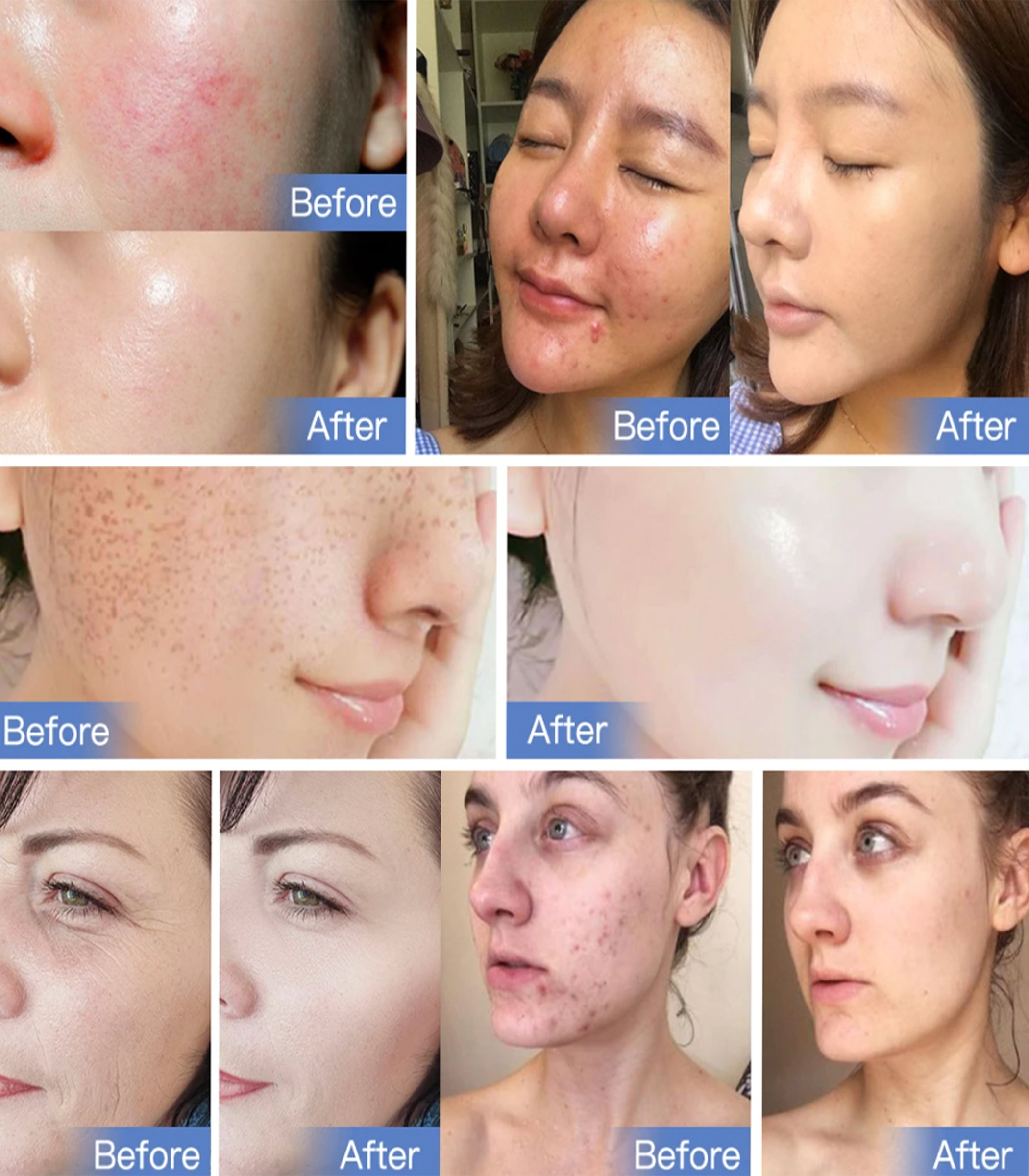 7 Colors Pdt Omega Led Light Therapy Machine Light Therapy – Theia